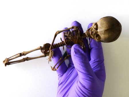 Atacama ‘alien’ mystery is no mystery | Zygoma